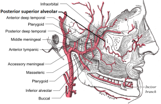 Posterior Superior Alveolar Block